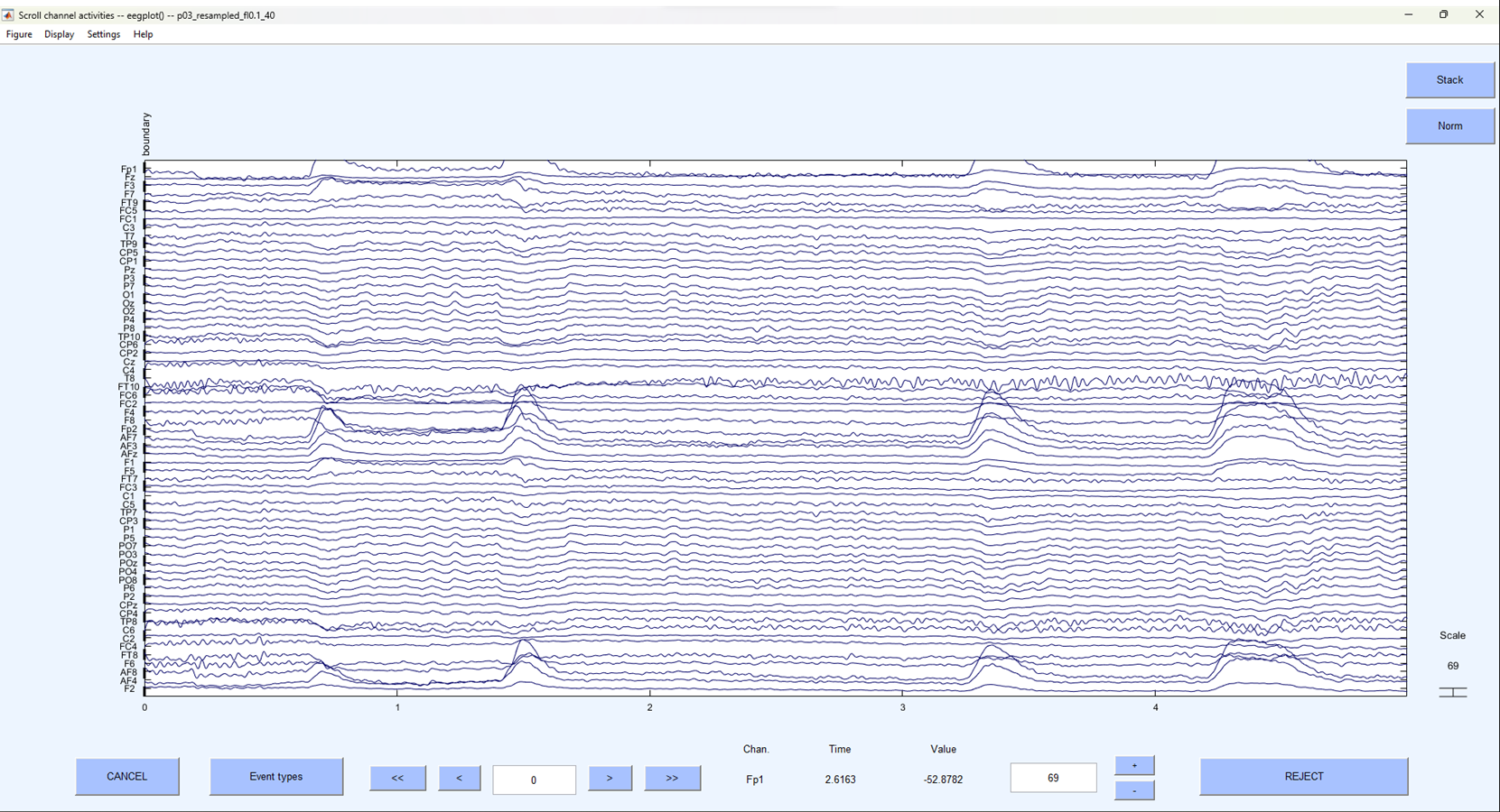 EEG Analysis - Filtering