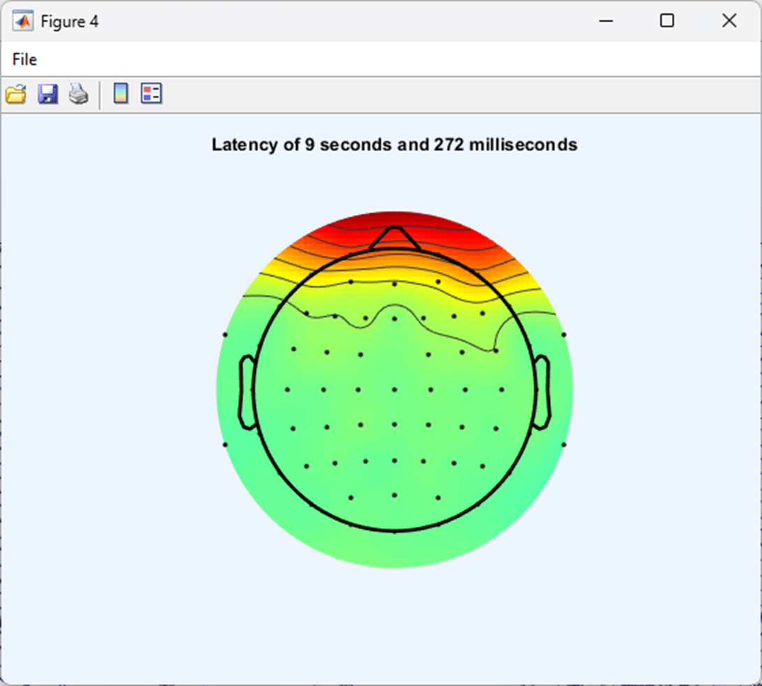EEG Analysis - Filtering EEG Analysis - Filtering