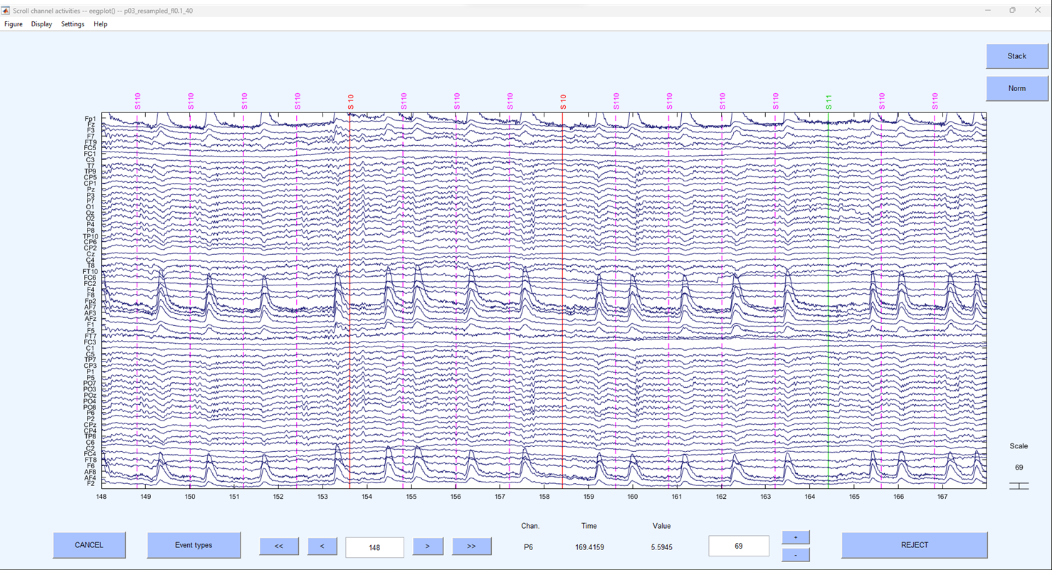 EEG Analysis - Filtering