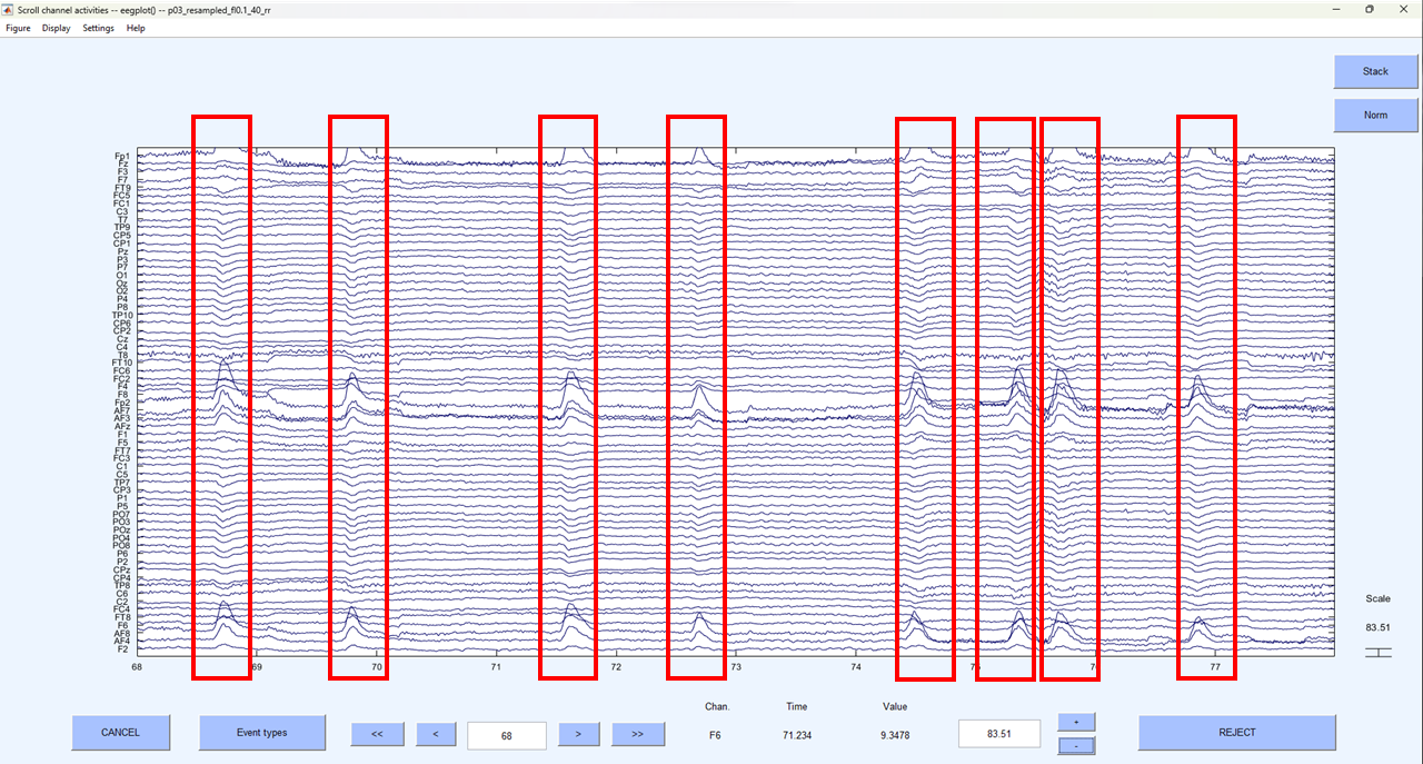 EEG Analysis - ICA