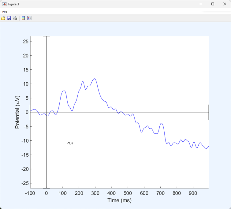 EEG Analysis - Segmentation