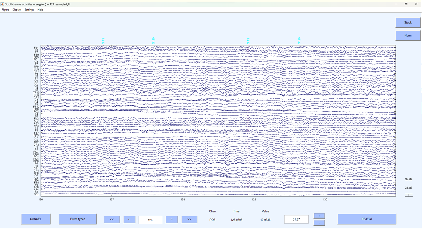 EEG Analysis - Interpolation