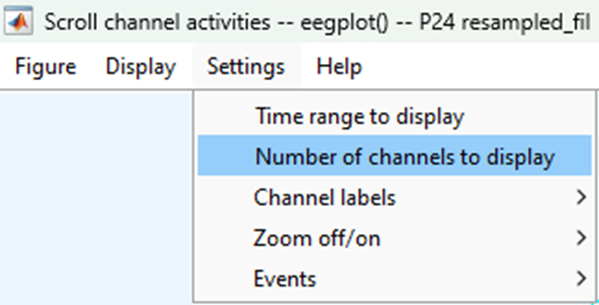 EEG Analysis - Interpolation
