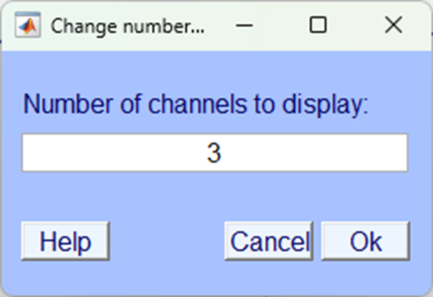 EEG Analysis - Interpolation