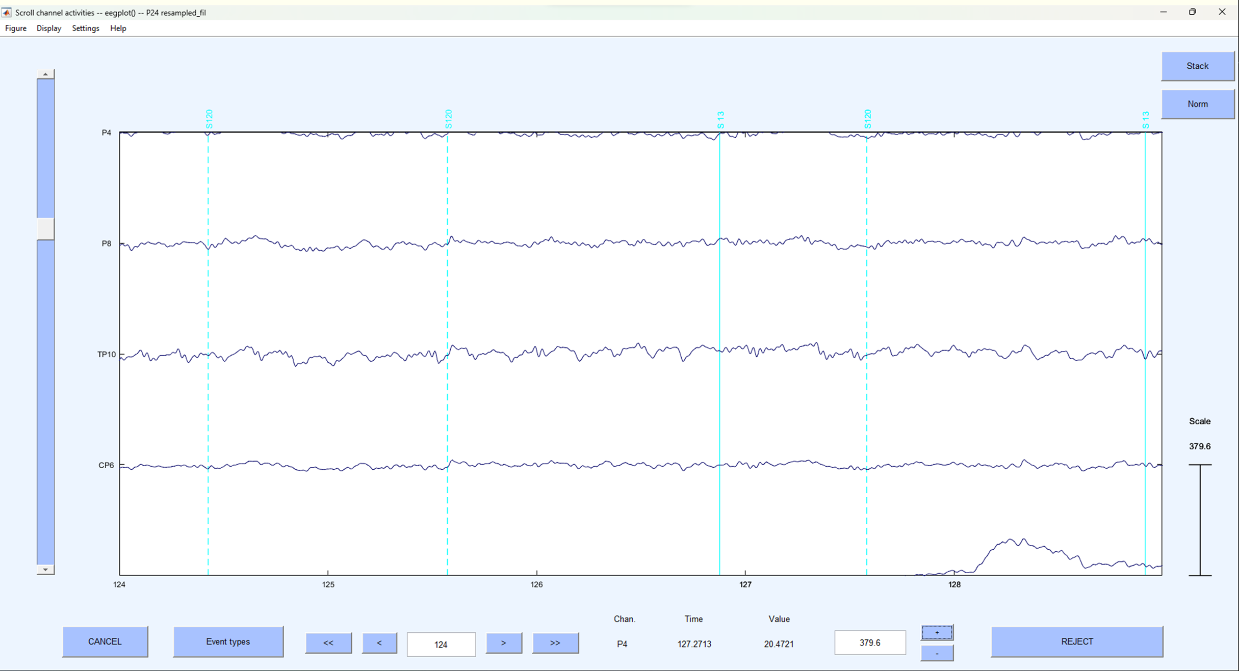 EEG Analysis - Interpolation