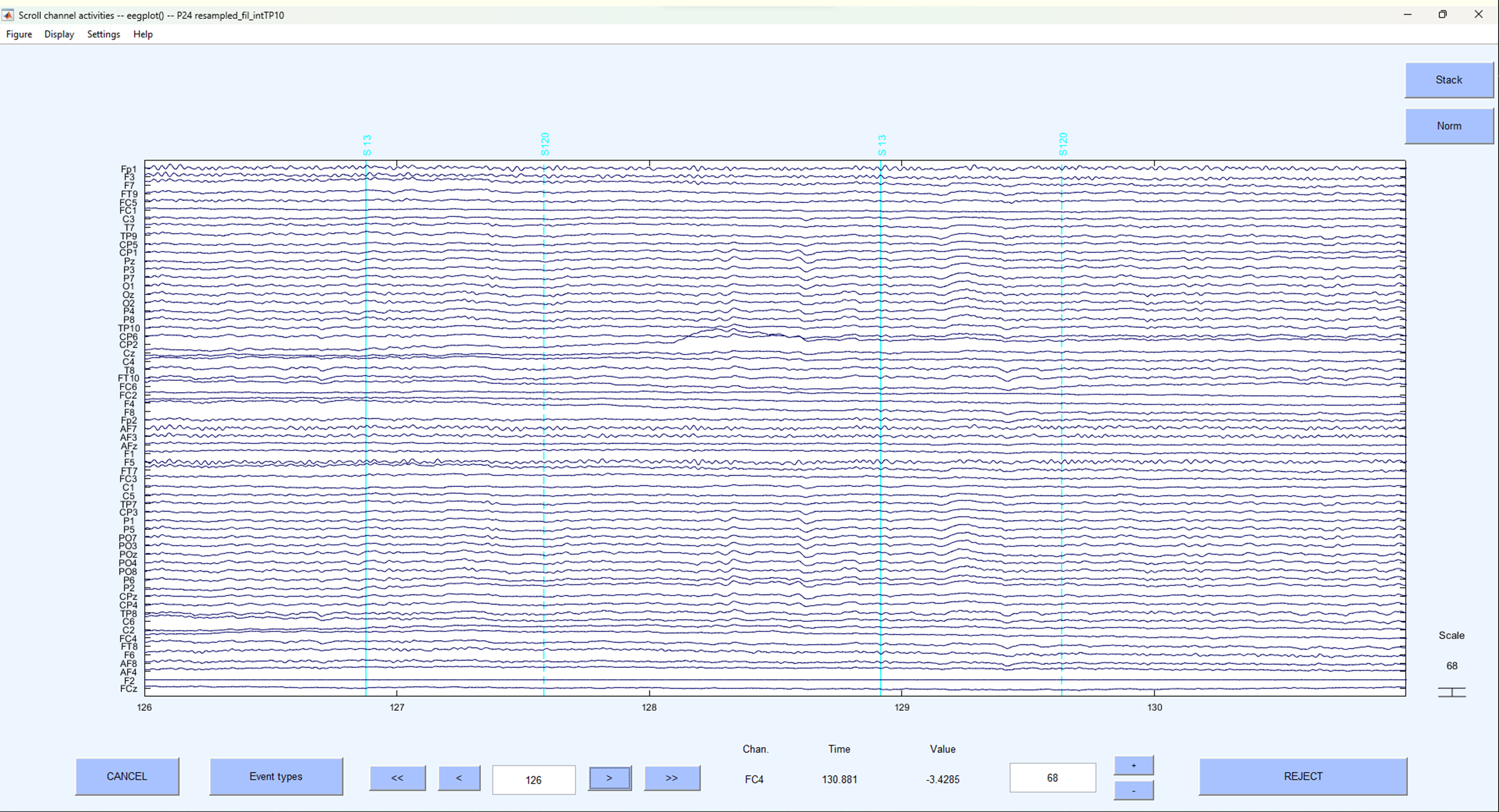 EEG Analysis - Interpolation