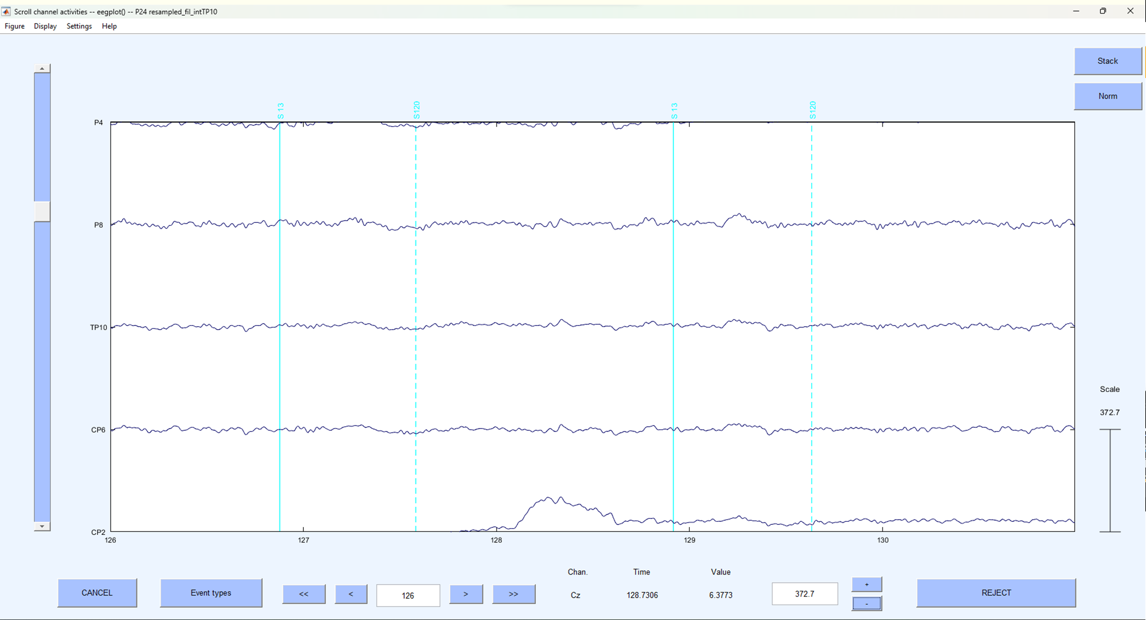 EEG Analysis - Interpolation