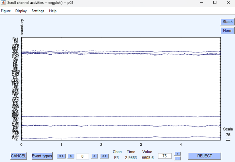 EEG Analysis - Eye-balling Data